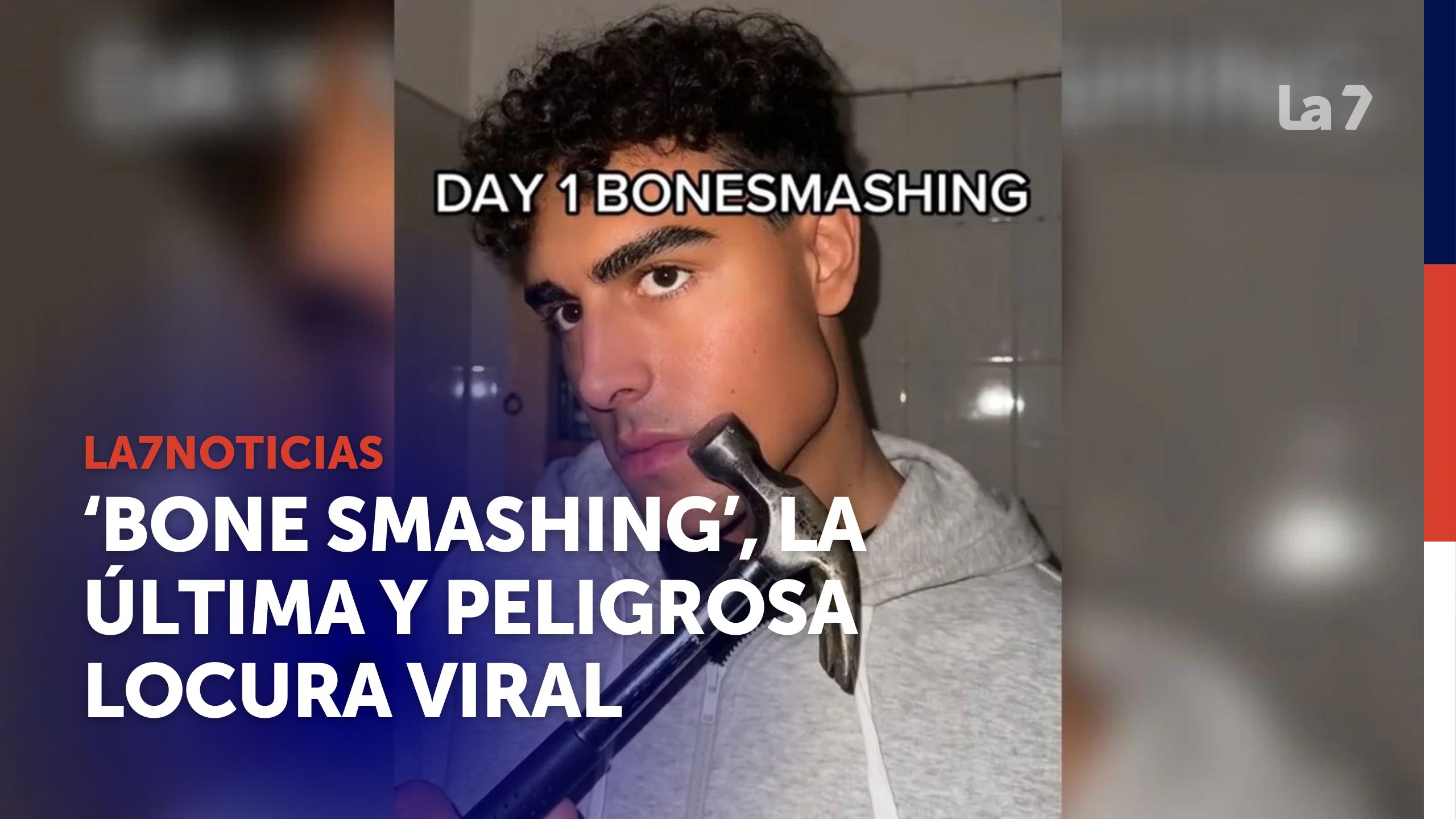 'Bone Smashing': la última locura en las redes que consiste en golpeare ...
